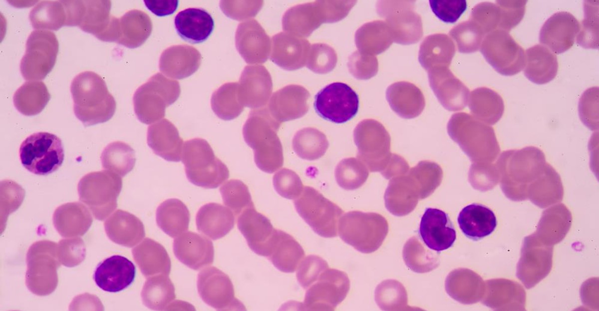 Limfocyty - funkcje, budowa, badanie, normy. Jak podnieść lub obniżyć ...