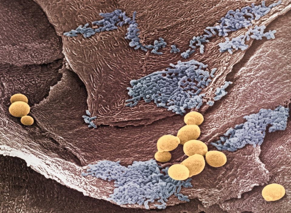 Choroby, których Polacy wstydzą się najbardziej: kiła, grzybica okolic ...