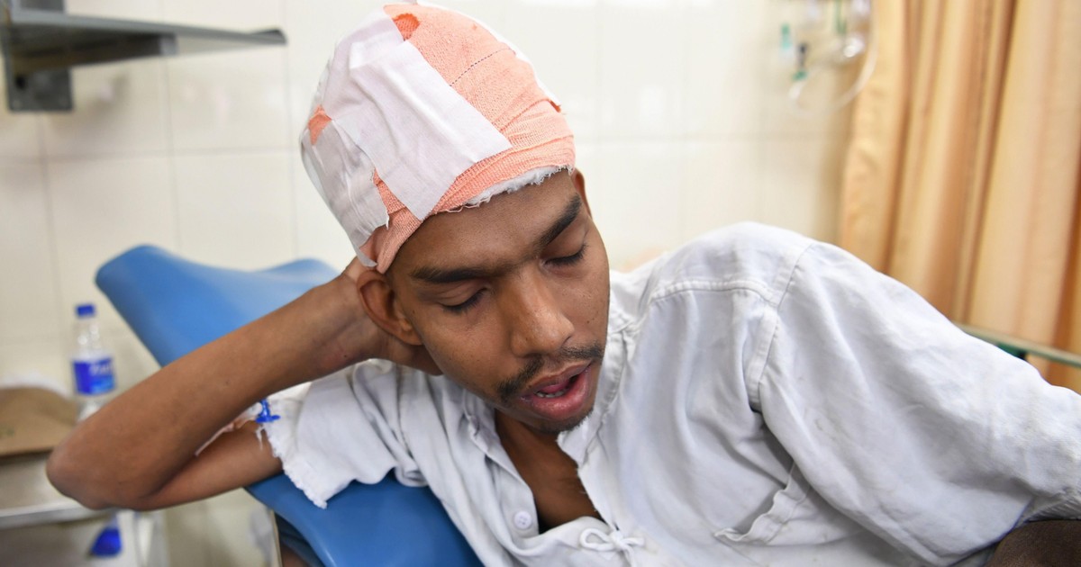 Gigantyczny guz mózgu! Jak on żył?