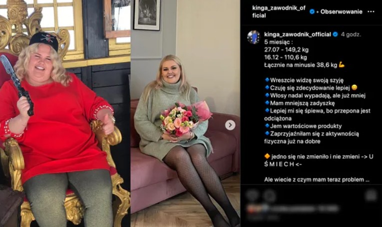 Kinga Zawodnik zdradza, ile schudła po operacji zmniejszenia żołądka ...
