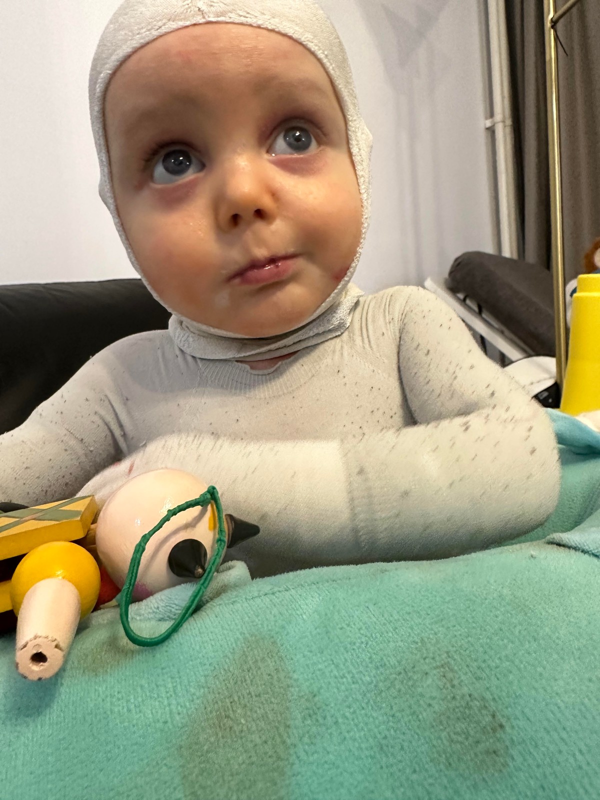 Mali Viktor je "dete leptir" i od bolova ne može da diše: Koža mu je u ...