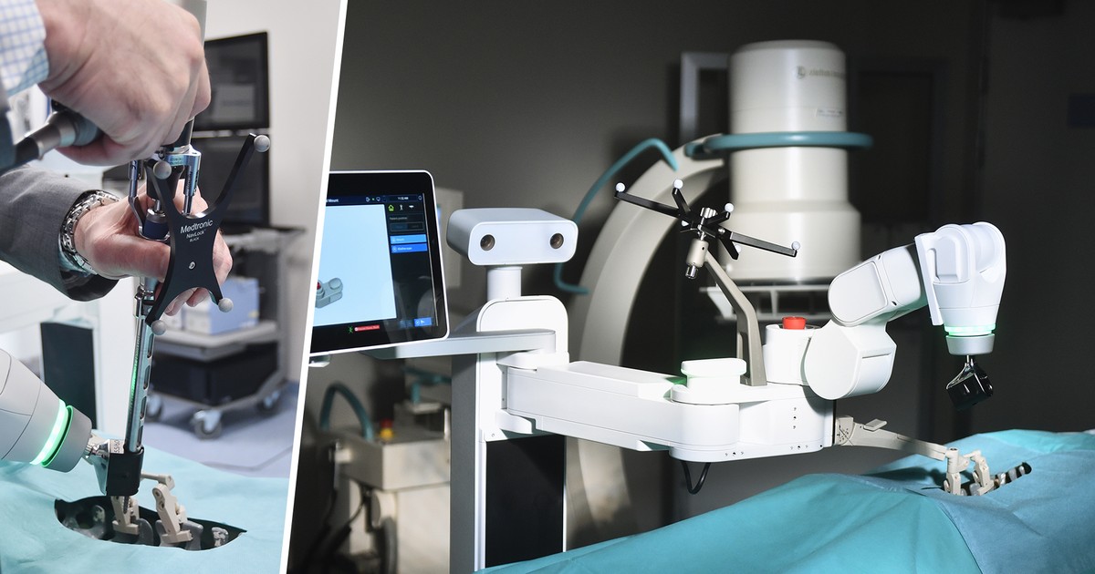 MAZOR X. Przybywa robotów chirurgicznych na salach operacyjnych