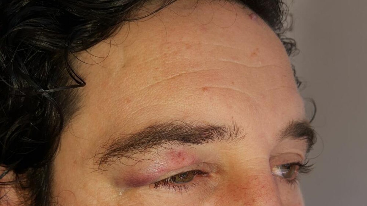 miljan davidovic igra sudbine glumac pretucen batine udarac - Blic