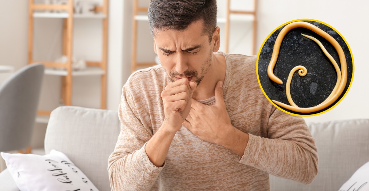 Glista ludzka - objawy zakażenia. Jak leczyć glistnicę?