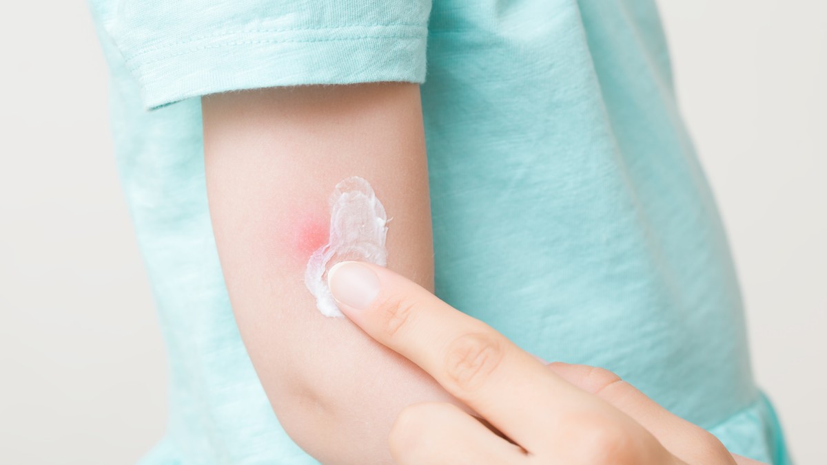 Robię pastę i nakładam na bąbel. To najlepszy sposób na ugryzienie ...