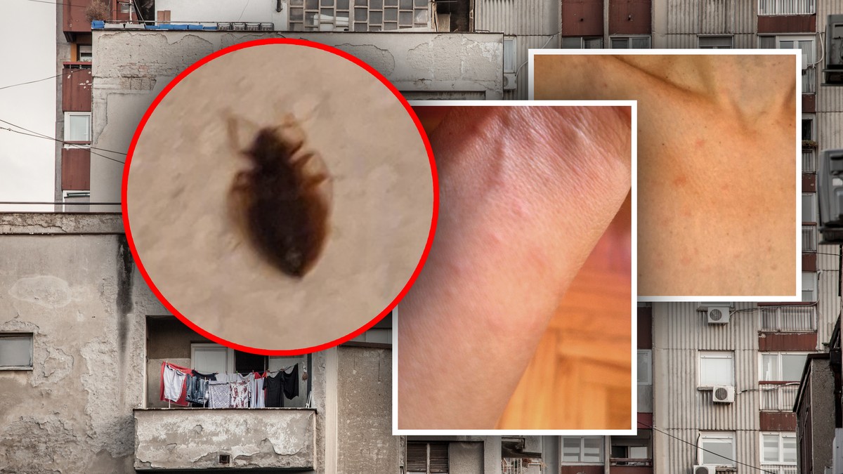 Kako da se rešite stenica u kući: Vide se samo noću, hrane se ljudskom ...