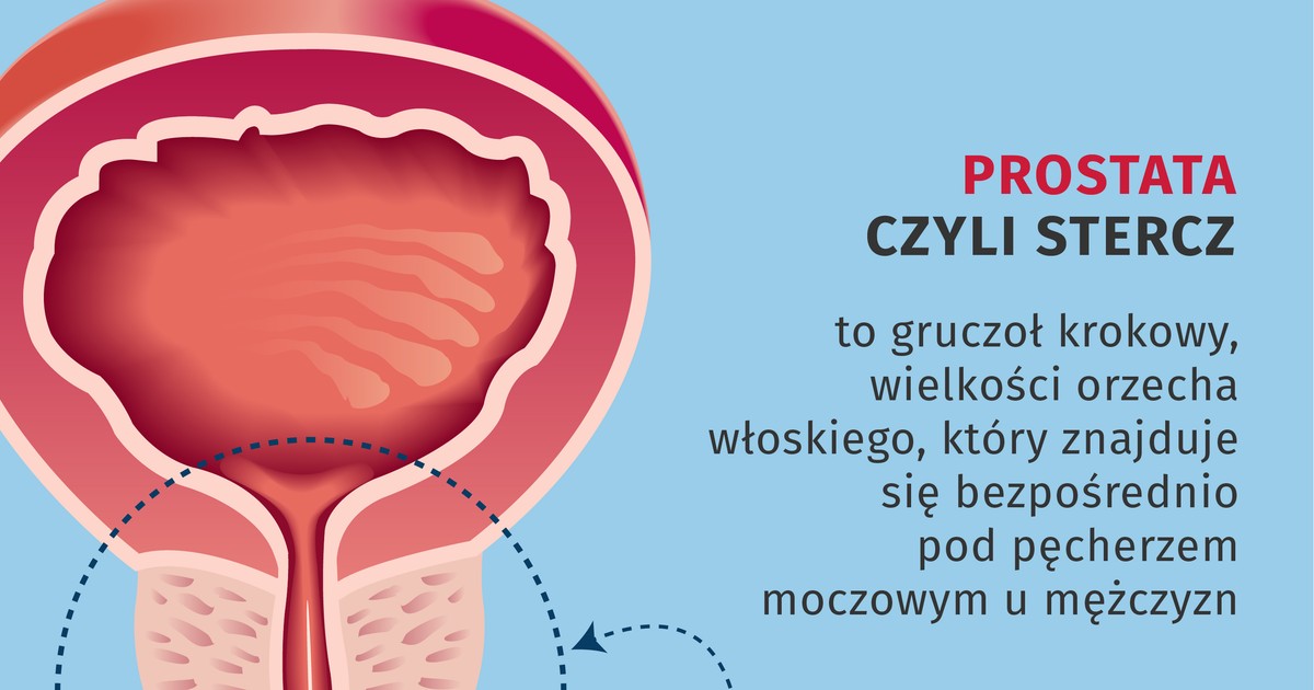 Prostata - co musisz o niej wiedzieć, a boisz się zapytać? [INFOGRAFIKA ...