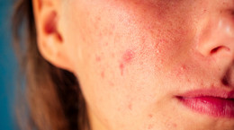 Tizanor - wskazania, działanie, przeciwwskazania