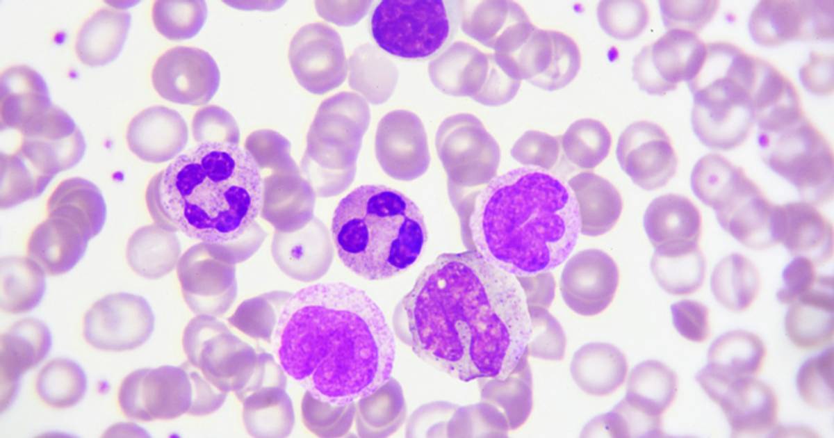 Eozynofile - normy, funkcje (czym są?) | Ofeminin