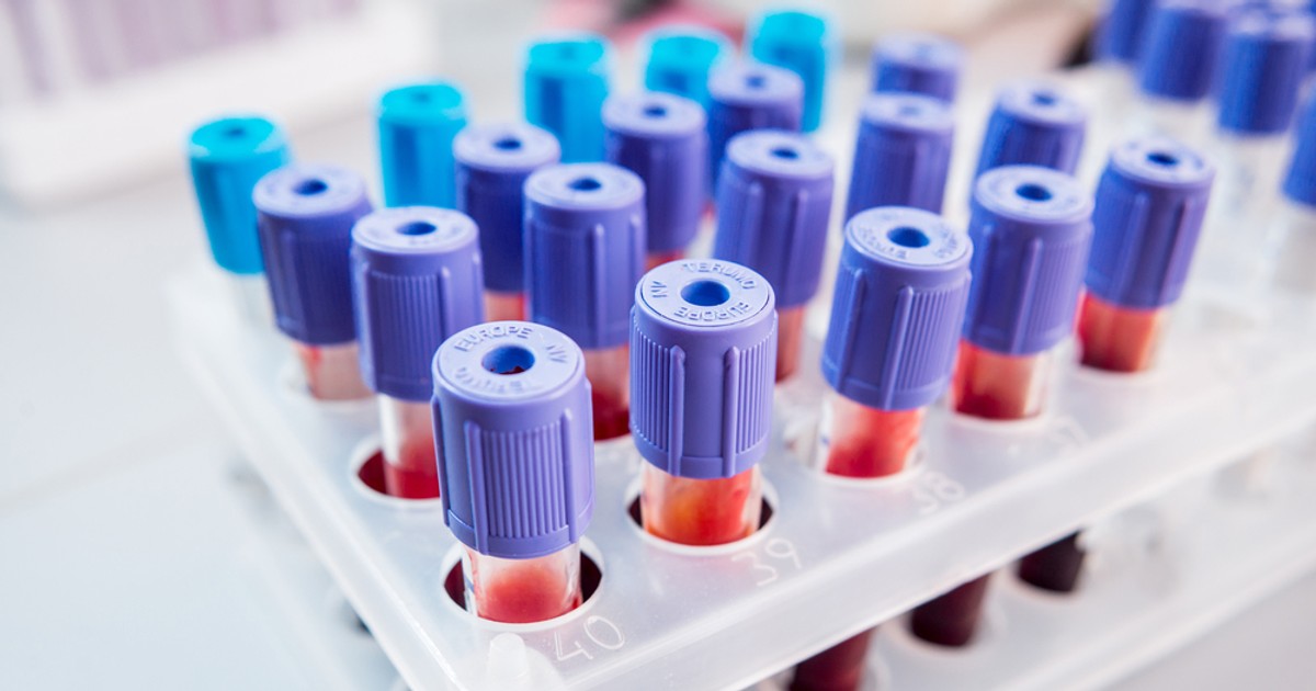 Androstendion - Zdrowie