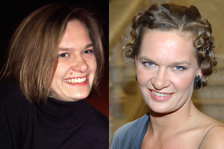 Maria Seweryn miała operację plastyczną. Aktorka pozbyła się pieprzyka ...