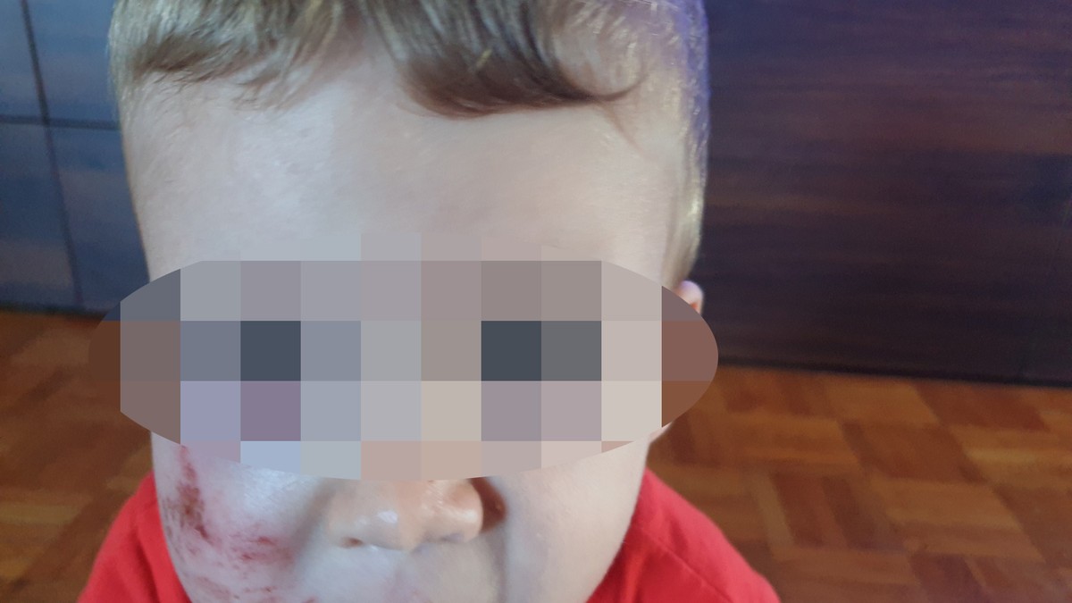 OVO JE DEČAK KOJI JE JUČE ISPAO IZ TRAMVAJA Ima veliki podliv i ...