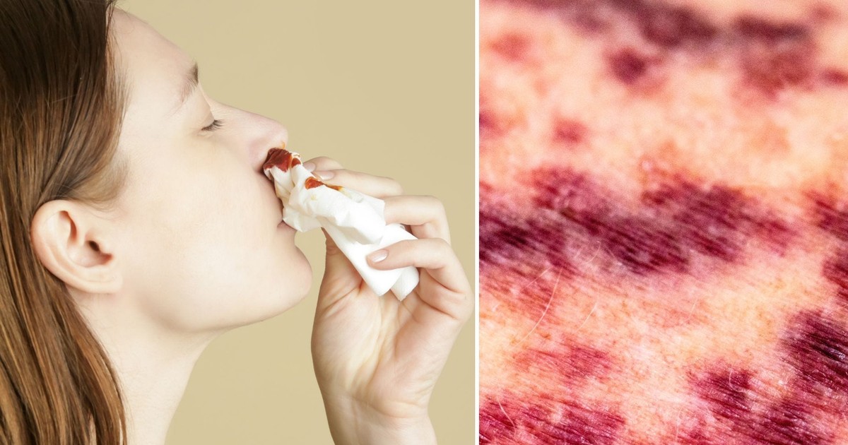 A 19-year-old thought the tiny red spots on her body were a harmless ...