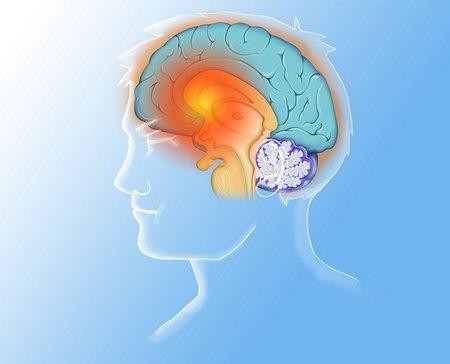 Czy to migrena? 15 powodów bólu głowy