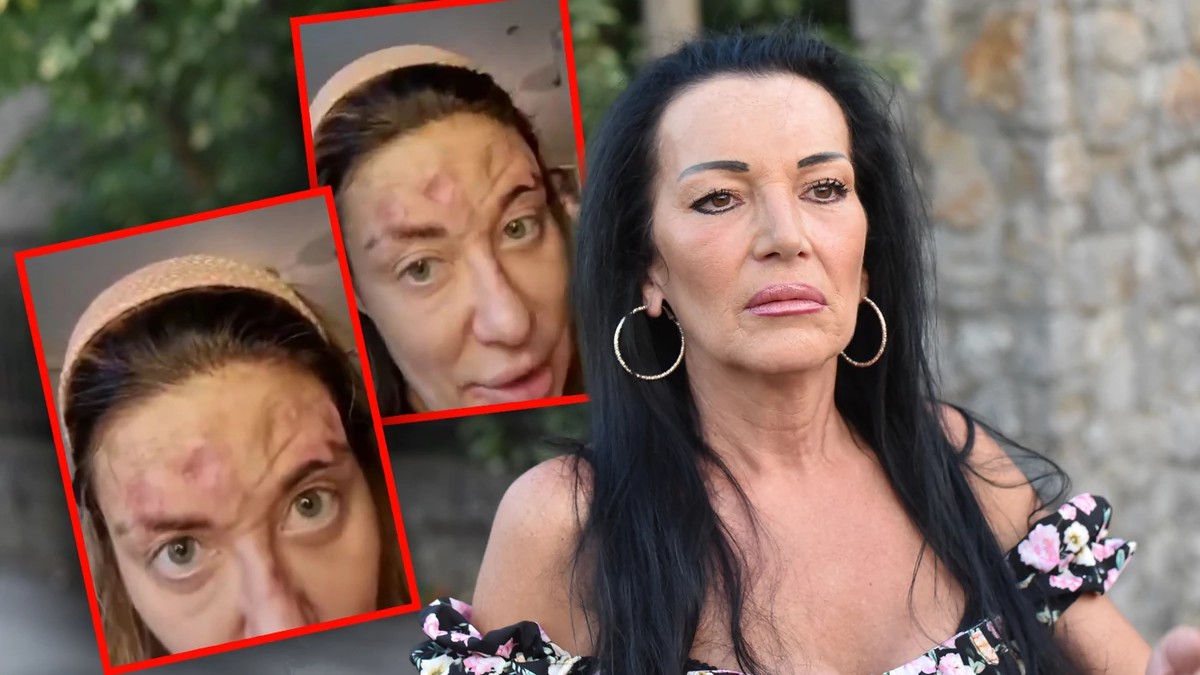 Goca Božinovska otkrila da Ana Nikolić ima kratere i rane i po telu