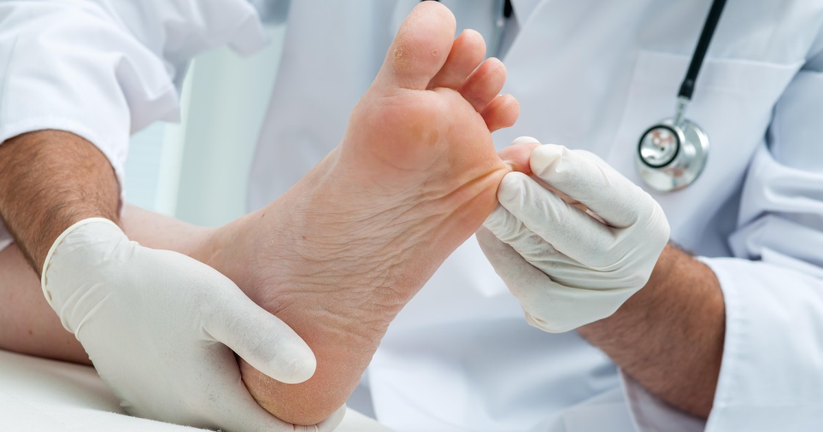 Sposoby na grzybicę stóp. Grzybica stóp.