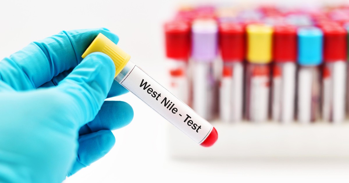 Zespół Westa - co to, przyczyny, objawy, leczenie