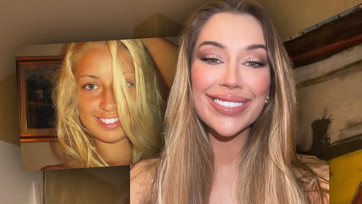 Tea Tairoviić pre operacija: Operisala nos, jagodice, usne, bradu - Blic