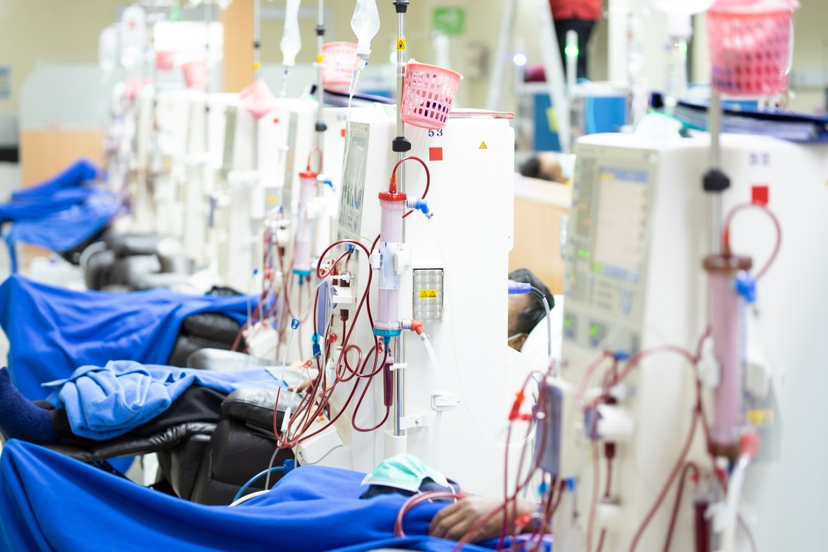 Mit jelent a dialízis? | EgészségKalauz