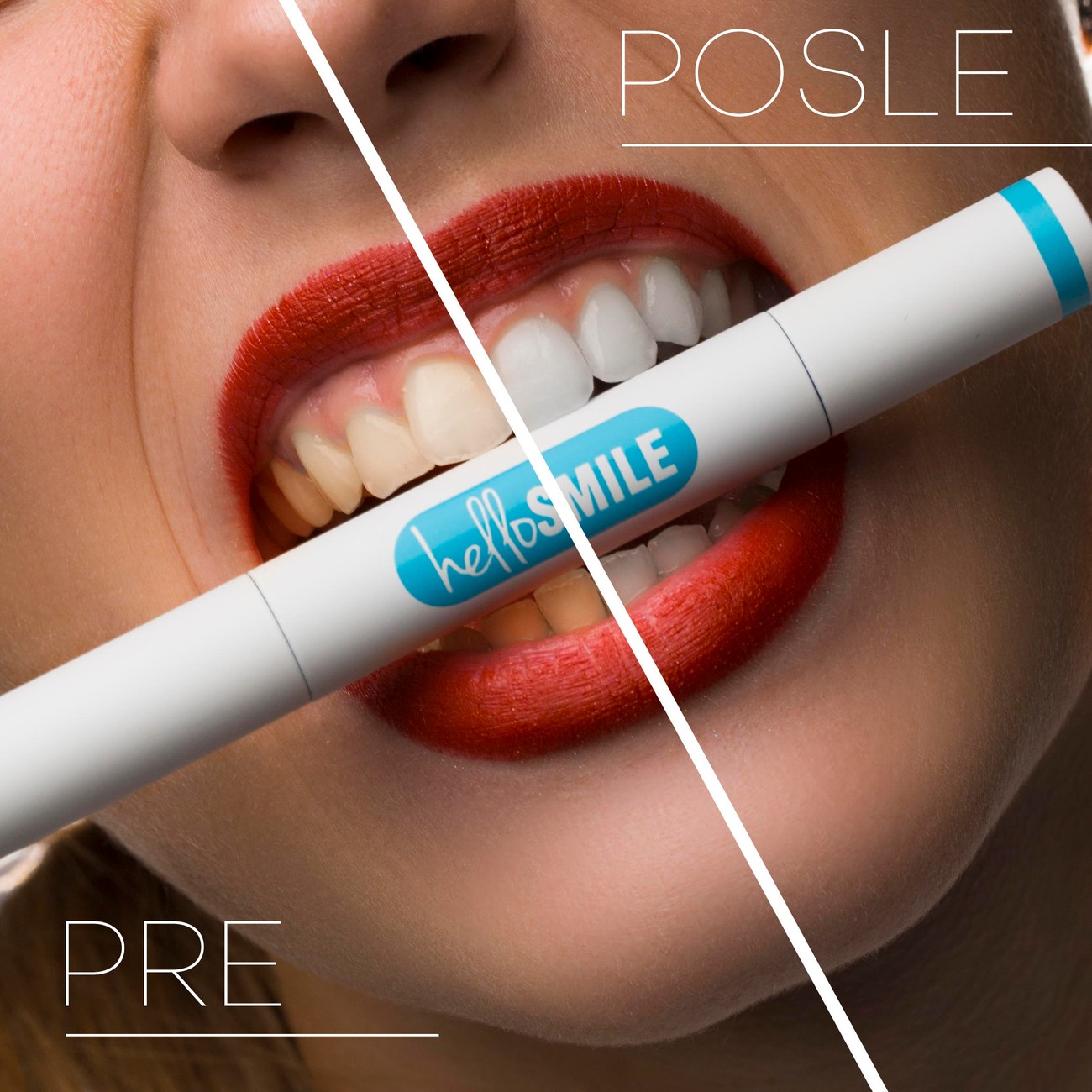 HelloSmile izbeljivanje zuba olovka za izbeljivanje zuba - Blic