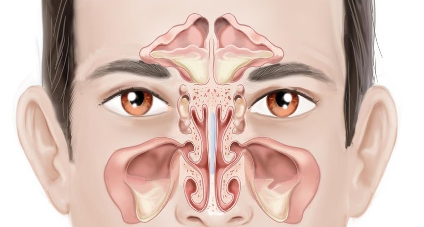Wszystko, co musisz wiedzieć o zatokach