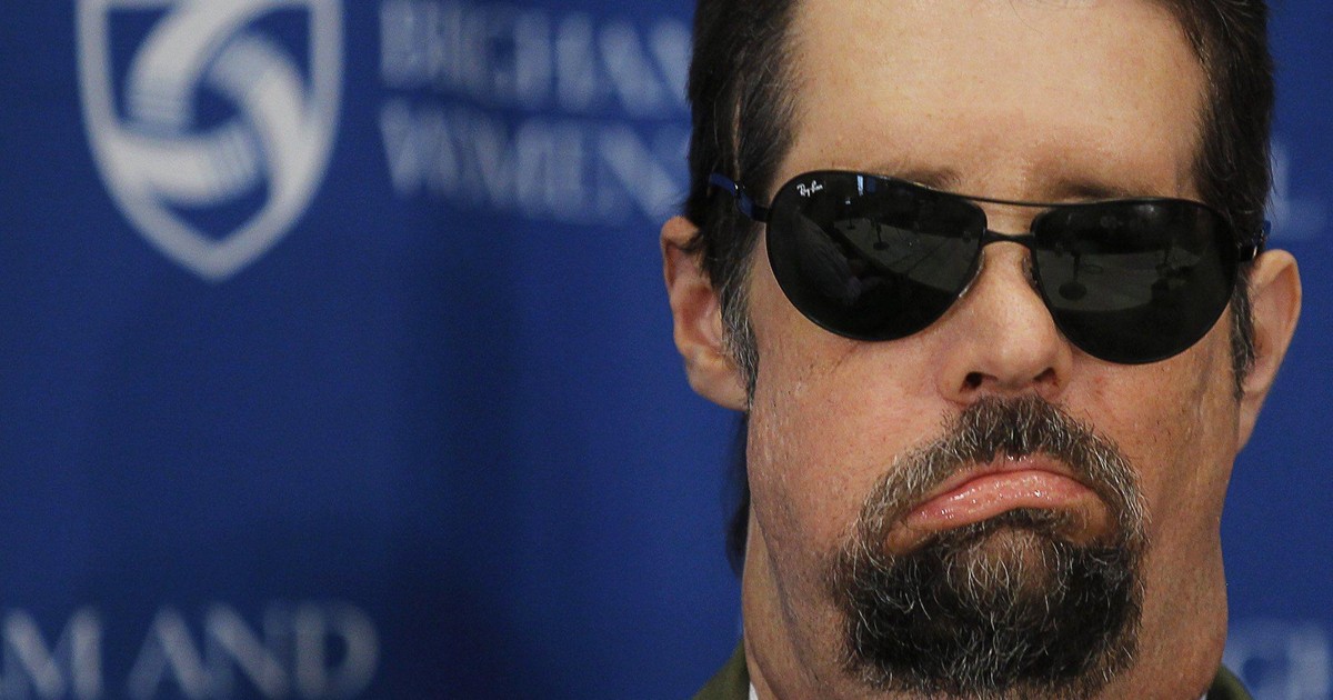 Życie z nową twarzą - Wiadomości