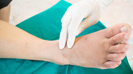 Zgorzel zęba - przyczyny, objawy, leczenie, konsekwencje