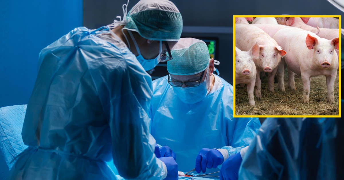 Zmarł pierwszy biorca zmodyfikowanej nerki od świni. "Dał nadzieję ...