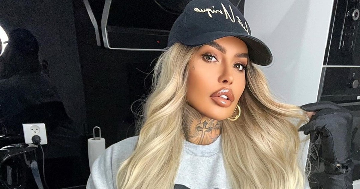 Laluna Unique pokazała efekty nowych operacji plastycznych. Przesadziła?