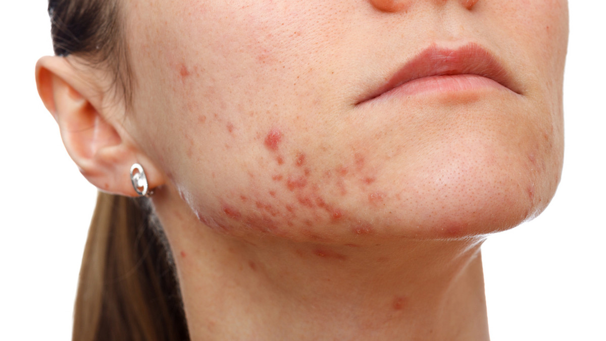 Davercin – tabletki, płyn, jakie ma działanie - Zdrowie