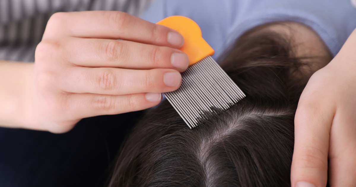 Jak pozbyć się wszy u dziecka? Lekarka ma kilka wskazówek