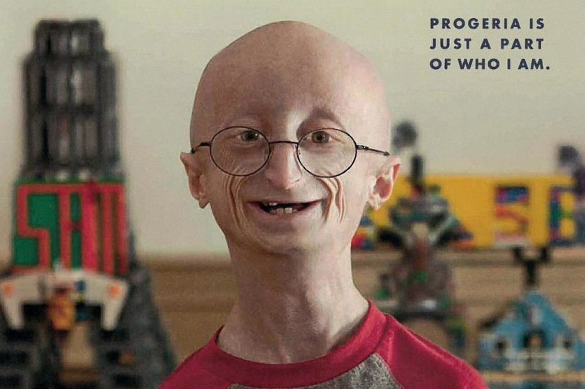 Zmarł Sam Berns. Sam Bern nie żyje