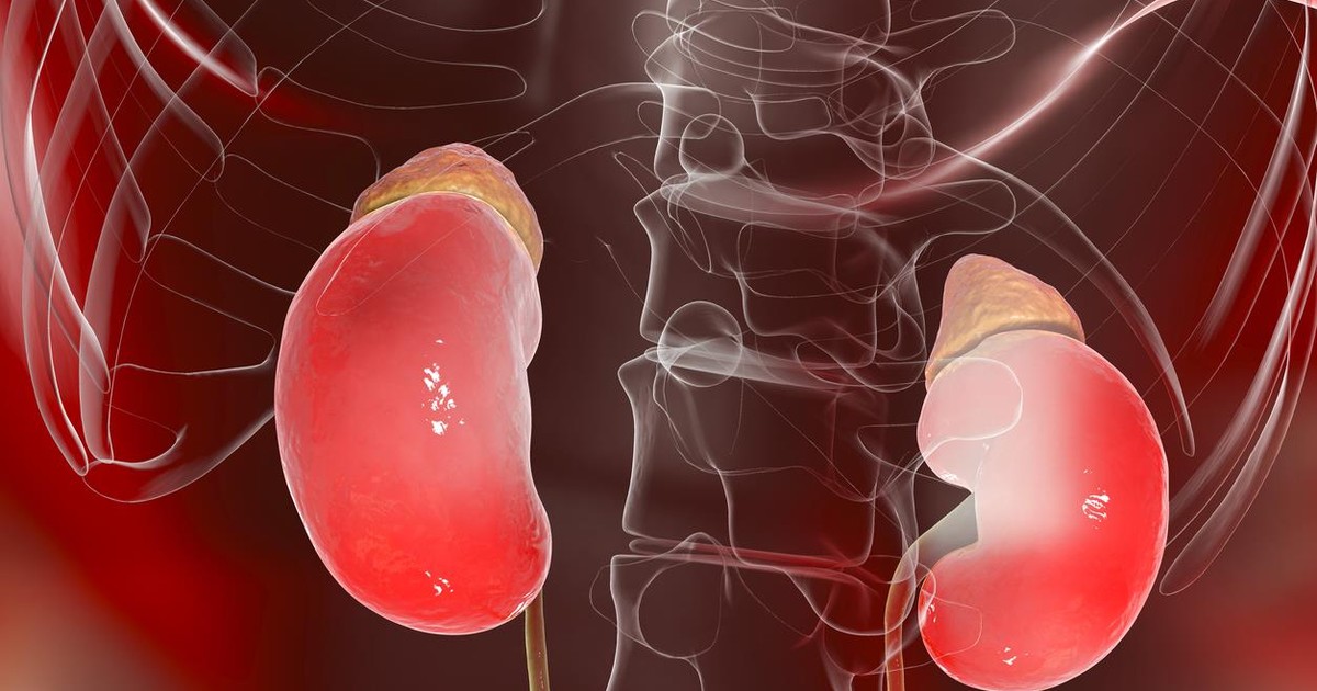Symptomy świadczące o chorobach nerek