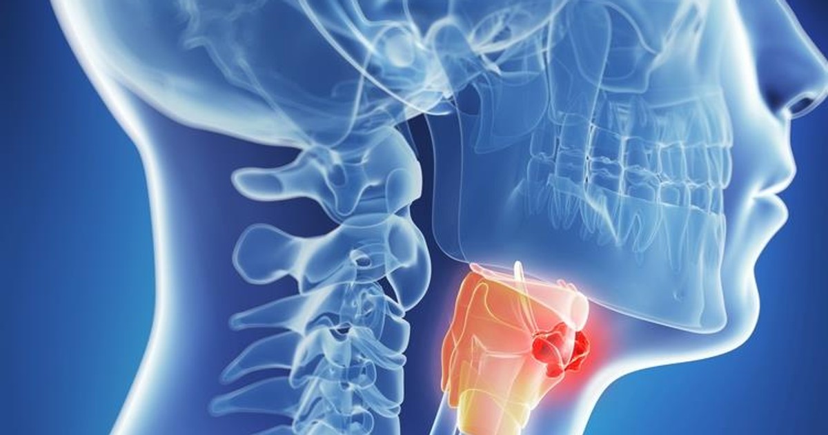 Tracheostomia - na czym polega? Rodzaje i przebieg tracheostomii