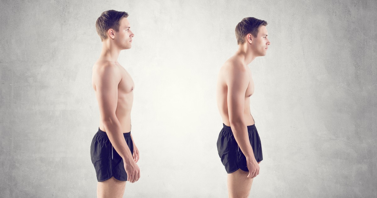 Kifoza, czyli okrągłe plecy. Co warto o niej wiedzieć?