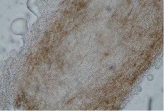 Dermatofitoza