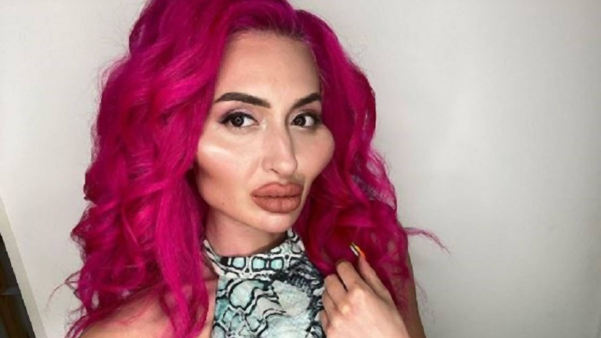 Devojka sa najvećim obrazima na svetu postala viral Noizz