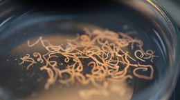 Glista ludzka - objawy zakażenia. Jak leczyć glistnicę?