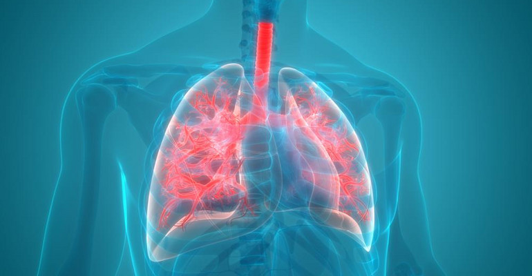 Pylica płuc - przyczyny, objawy, leczenie i profilaktyka