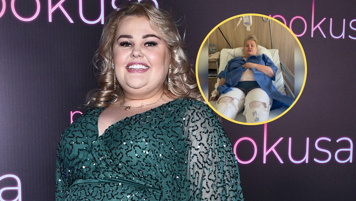 Kinga Zawodnik o skutkach ubocznych operacji bariatrycznej. Pokazała ...