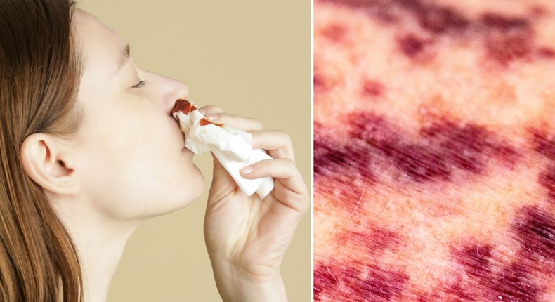 A 19-year-old thought the tiny red spots on her body were a harmless ...