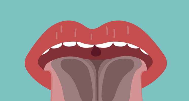 Rak języka - przyczyny, objawy, diagnostyka i leczenie