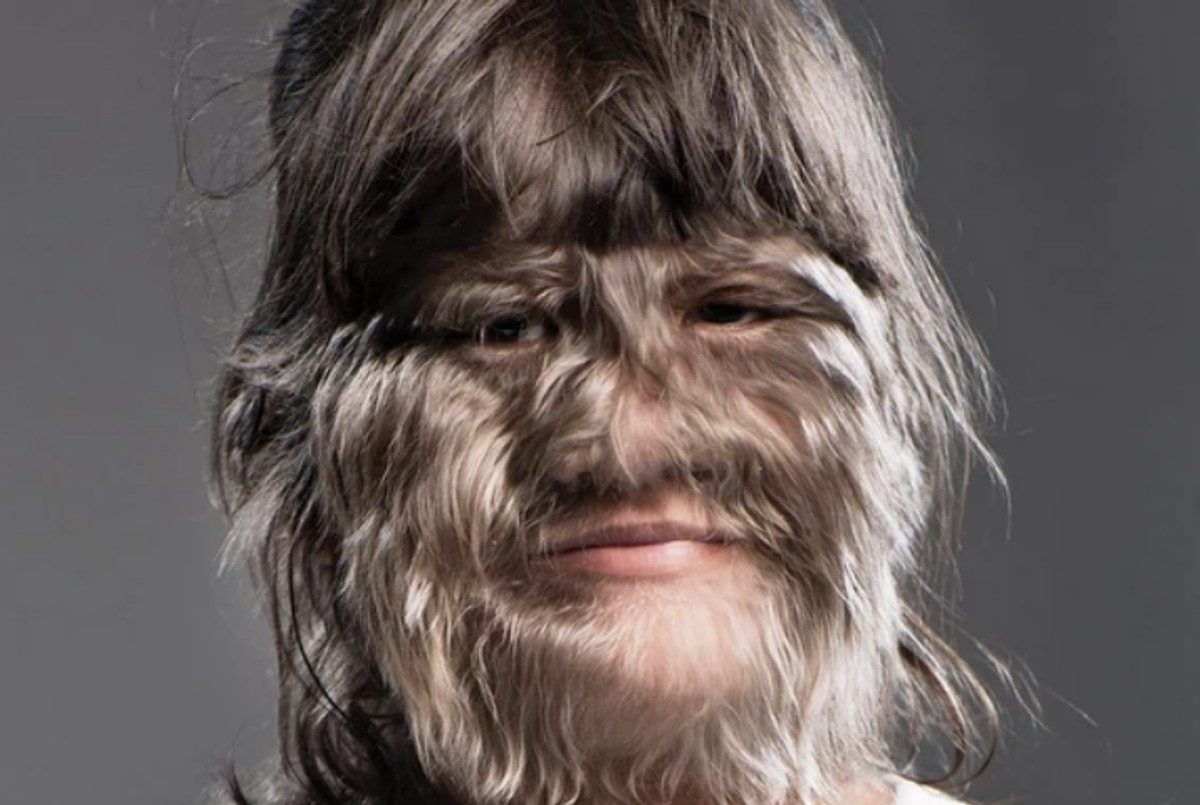 Evo kako danas izgleda najdlakavija devojčica na svetu - Žena.rs