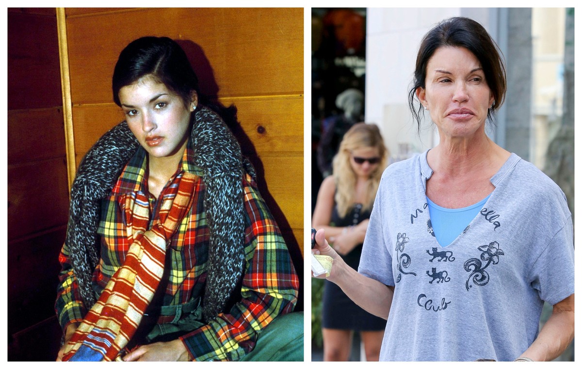 Dženis Dikinson imala brojne platične operacije i danas je ...