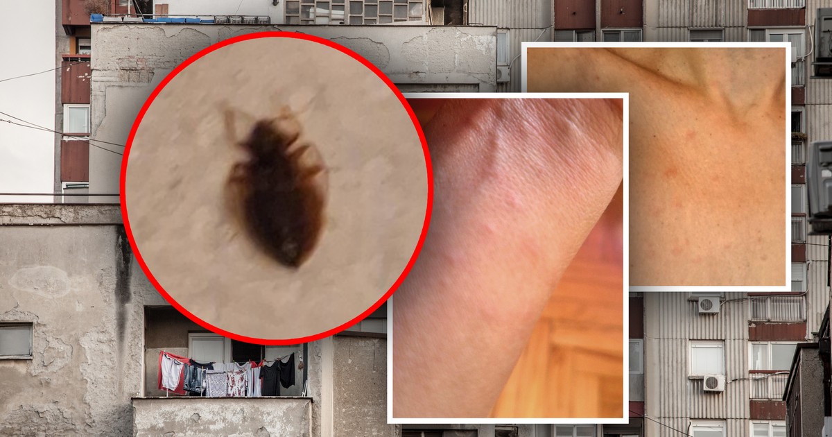 Skoro mesec dana živela u agoniji: Ispovest Beograđanke koja je bila na ...