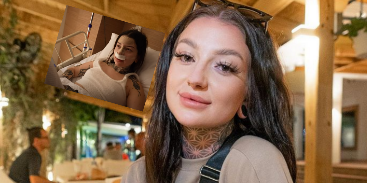 Marcysia Ryskala z Ekipy zoperowała nos. Pokazała nagranie - Plejada.pl