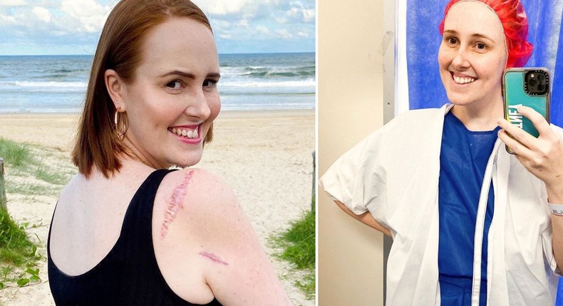 A 29-year-old woman thought she wouldn't get skin cancer because she ...