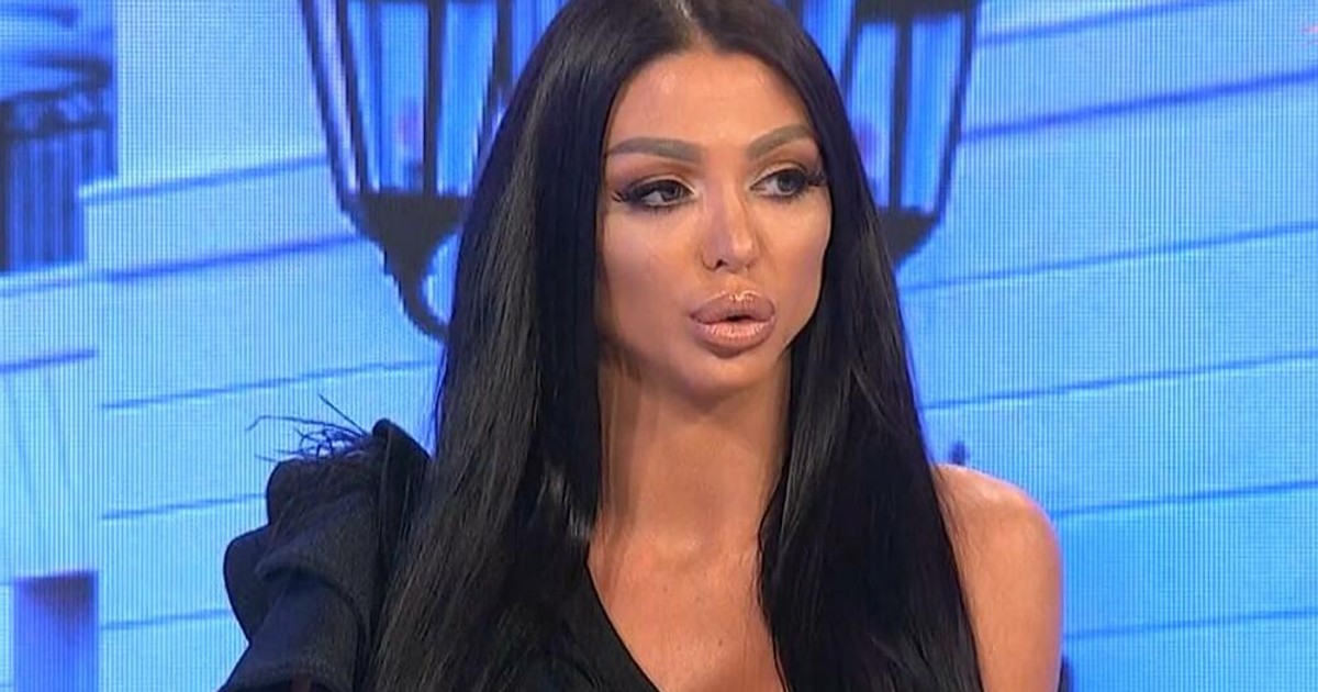 maja marinkovic operacija lice kapci macje oci ana korac - Blic