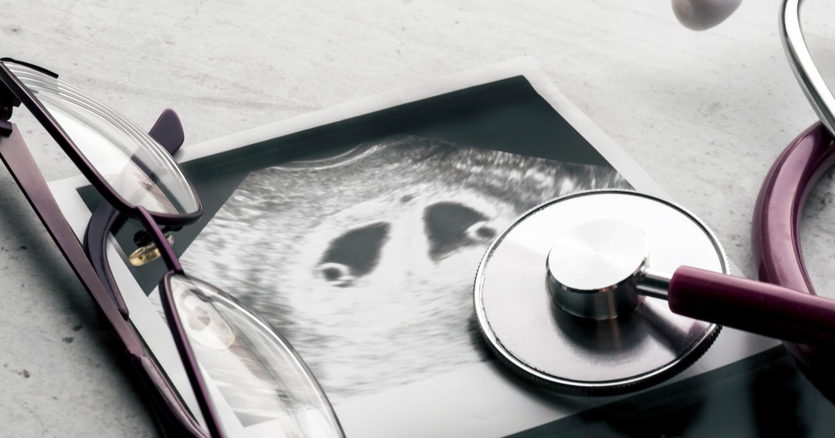 Egy sima ultrahang vizsgálatra mentek, alig kaptak levegőt, amikor ...