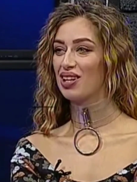 Tea Tairoviić pre operacija: Operisala nos, jagodice, usne, bradu - Blic